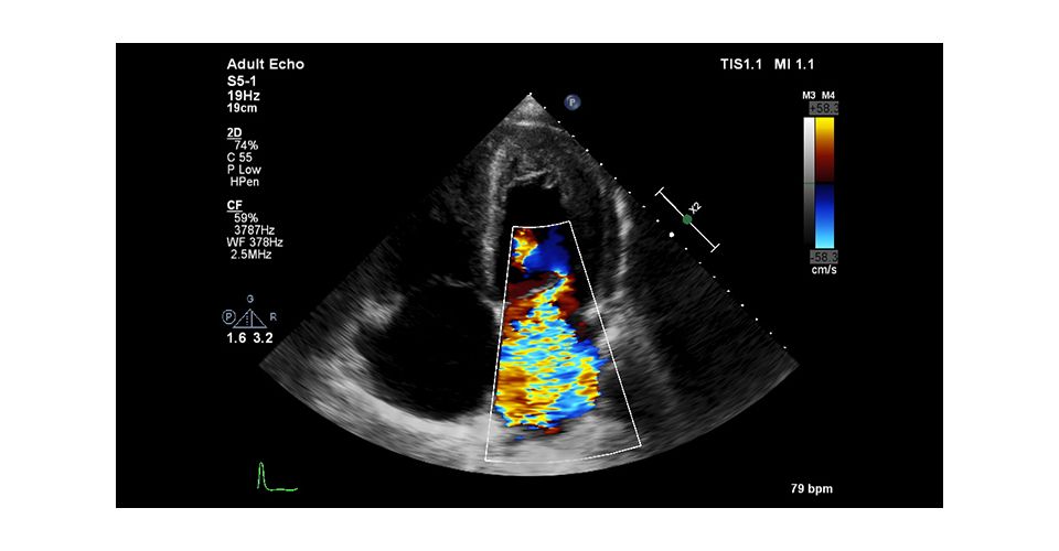 O que esperar do 7C – EchoTalk