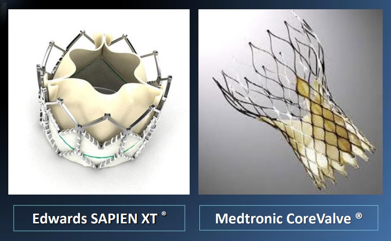 TAVI precisa de TEE? – EchoTalk