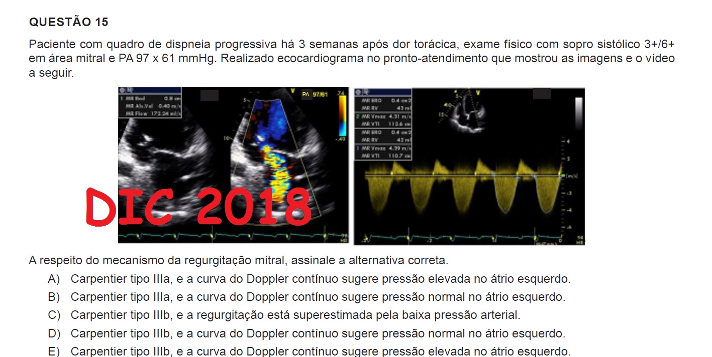 Prova A do Eco. DIC 2018 – EchoTalk