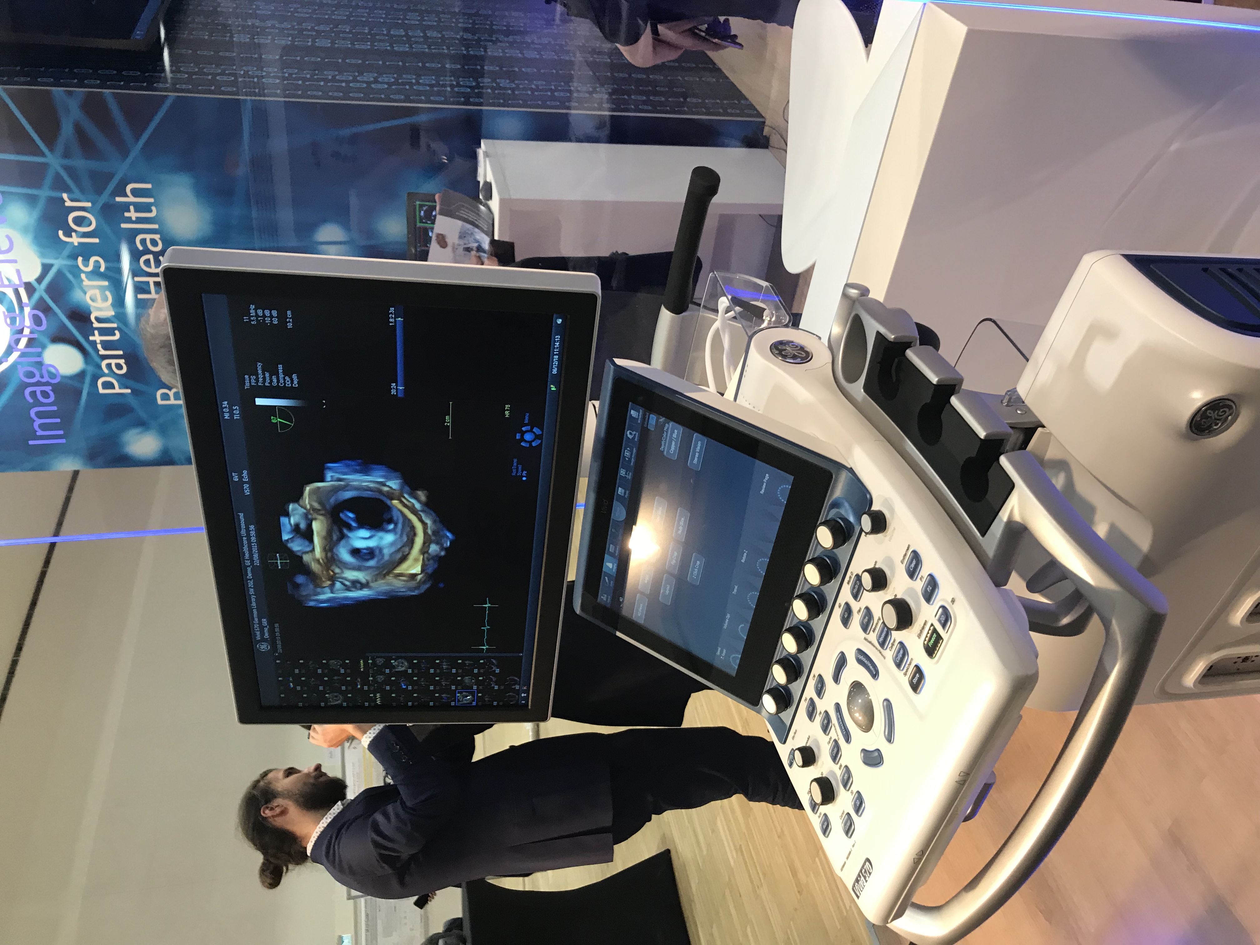 EuroEcho 18: Nosso 3D – EchoTalk