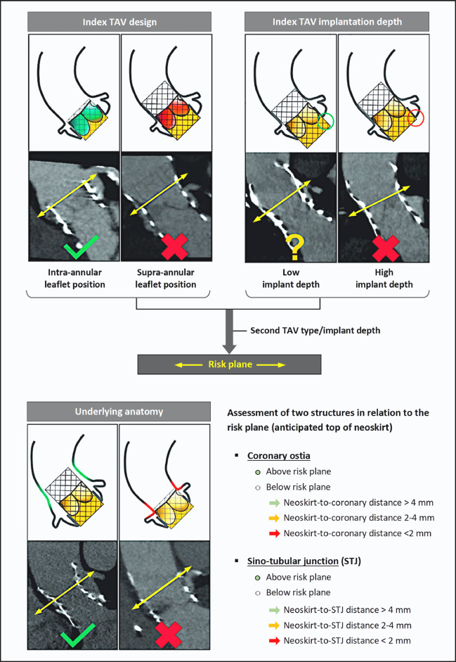 TAV mais TAV – EchoTalk